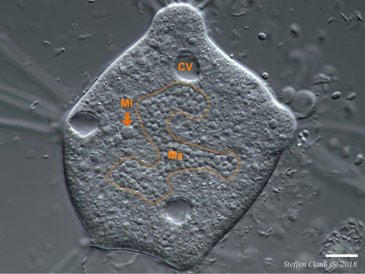 Trichophrya astaci - ein Sauginfusor