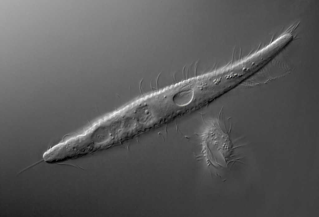 Cohnilembus verminus - mariner Ciliat
