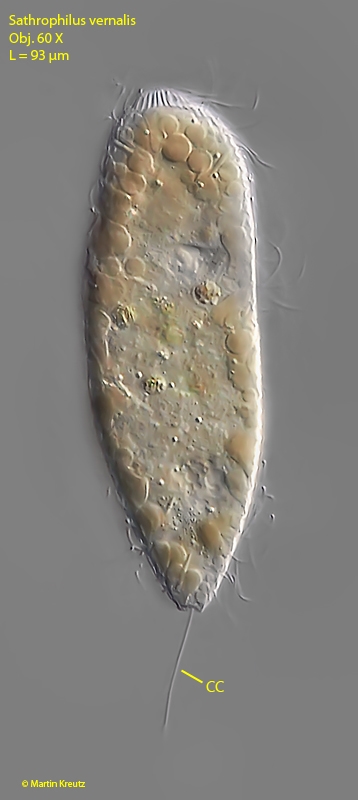 Plagiopyla nasuta und Sathrophilus vernalis – Zwei Ciliaten mit ...