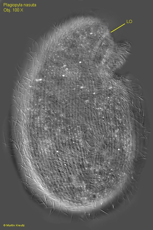 Plagiopyla nasuta und Sathrophilus vernalis – Zwei Ciliaten mit ...