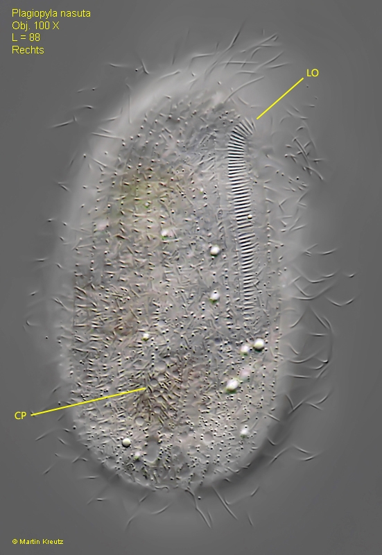 Plagiopyla nasuta und Sathrophilus vernalis – Zwei Ciliaten mit ...