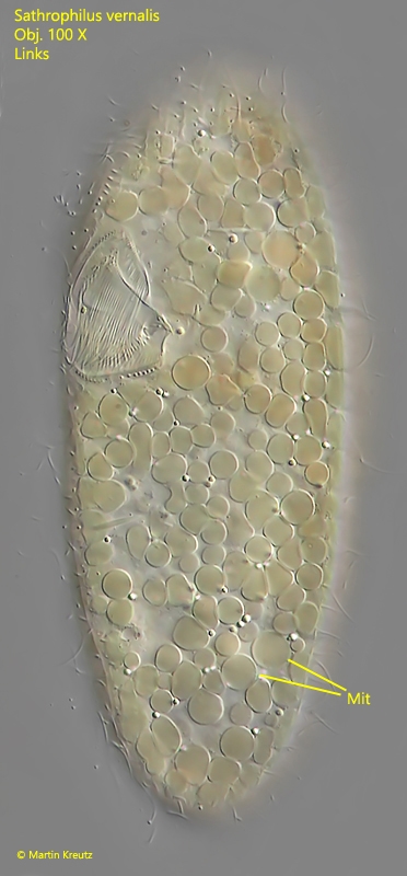Plagiopyla nasuta und Sathrophilus vernalis – Zwei Ciliaten mit ...