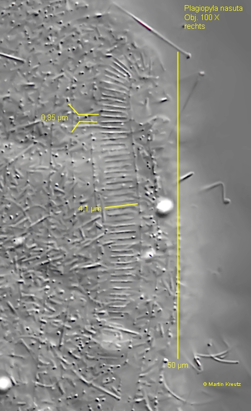 Plagiopyla nasuta und Sathrophilus vernalis – Zwei Ciliaten mit ...