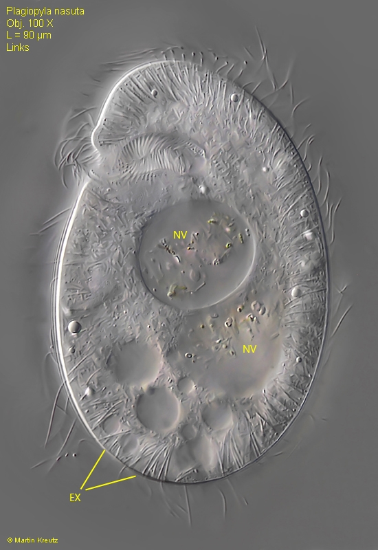 Plagiopyla nasuta und Sathrophilus vernalis – Zwei Ciliaten mit ...