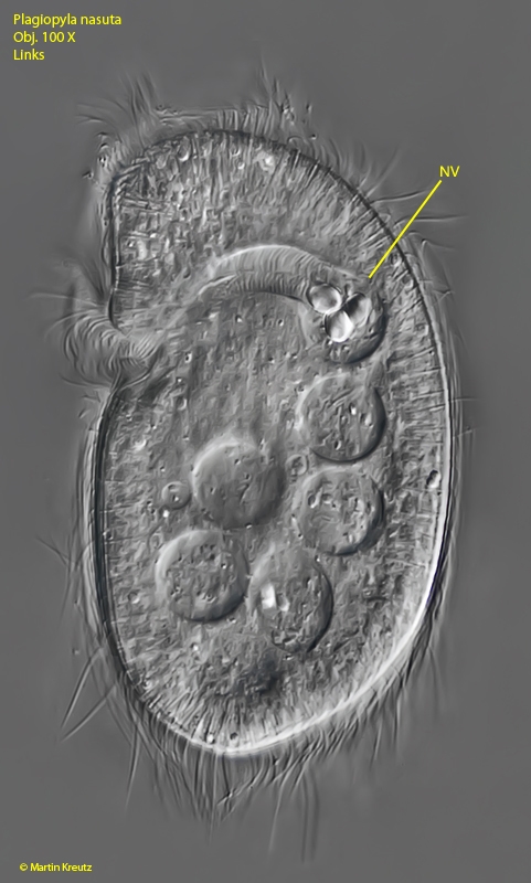 Plagiopyla nasuta und Sathrophilus vernalis – Zwei Ciliaten mit ...