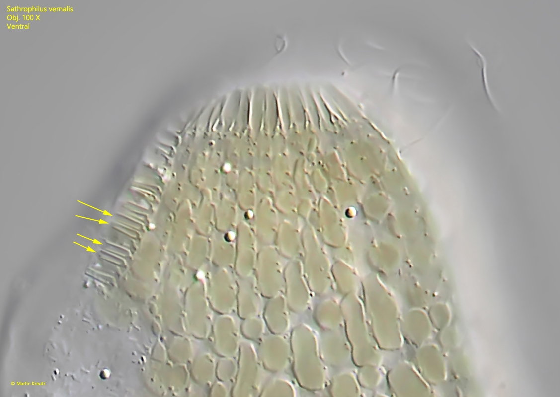 Plagiopyla nasuta und Sathrophilus vernalis – Zwei Ciliaten mit ...