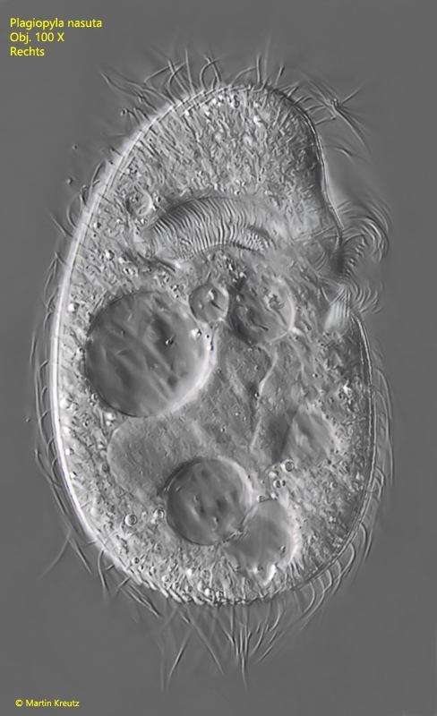 Plagiopyla nasuta und Sathrophilus vernalis – Zwei Ciliaten mit ...