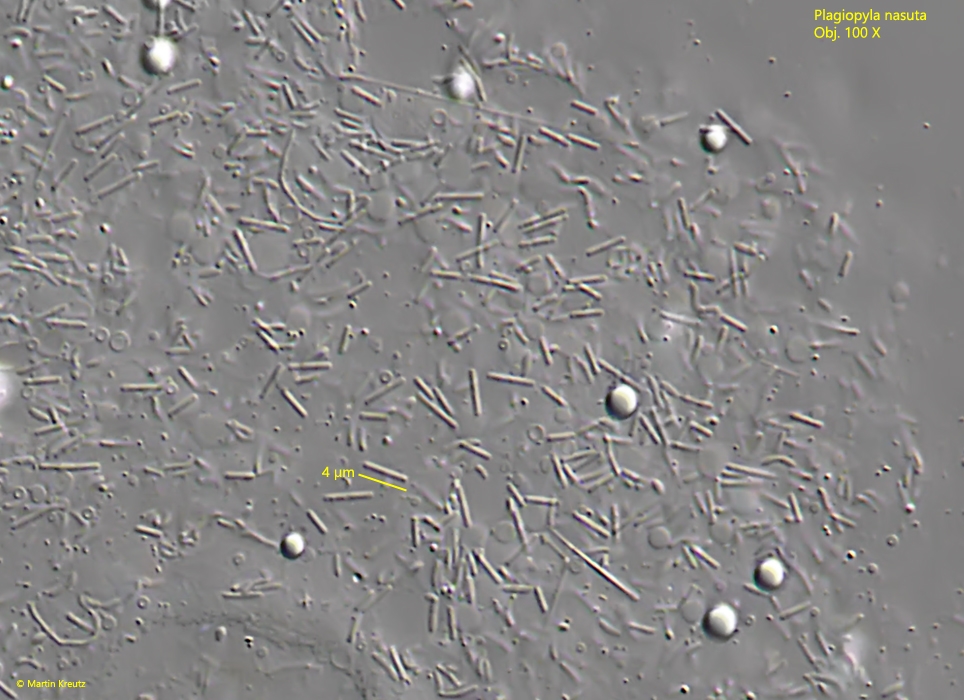 Plagiopyla nasuta und Sathrophilus vernalis – Zwei Ciliaten mit ...