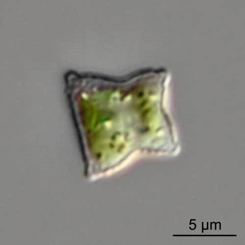 Grünalgen – Teil 4