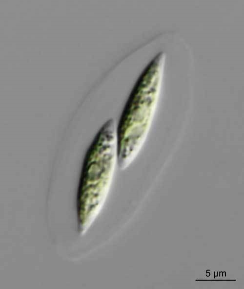 Grünalgen – Teil 4