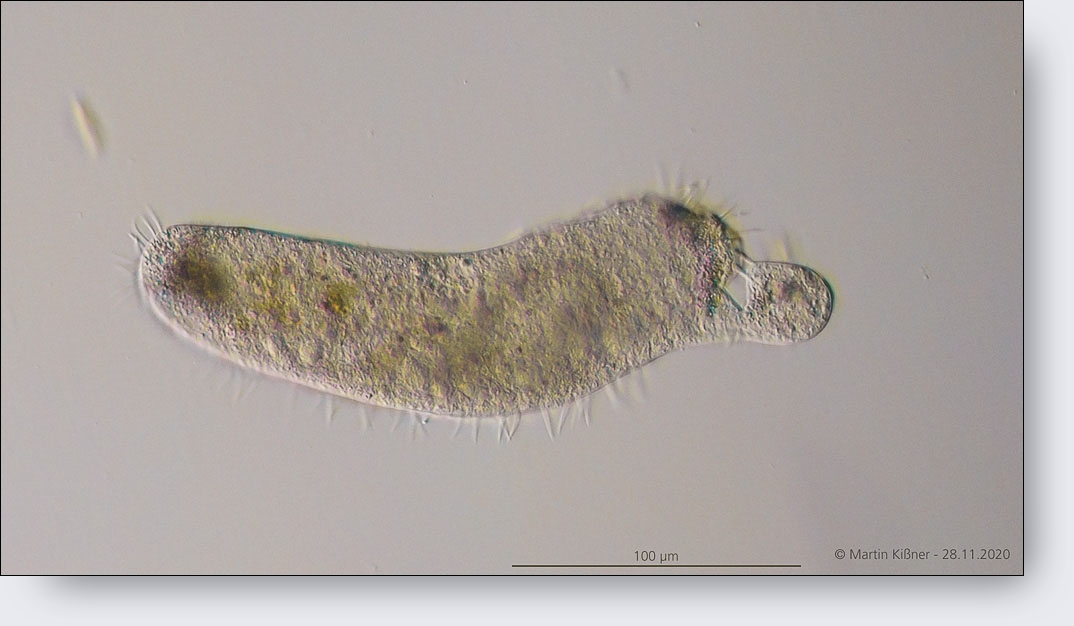 Ciliat mit Anhängsel