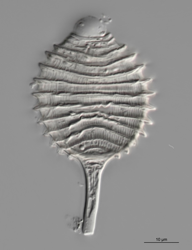 Das Sauginfusor Podophrya globulifera – Teil 3