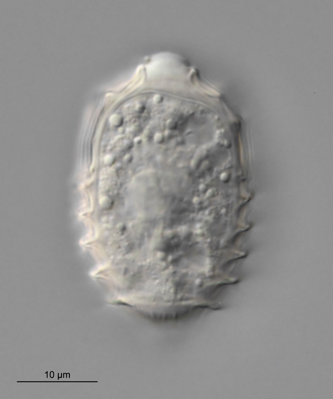 Das Sauginfusor Podophrya globulifera – Teil 3