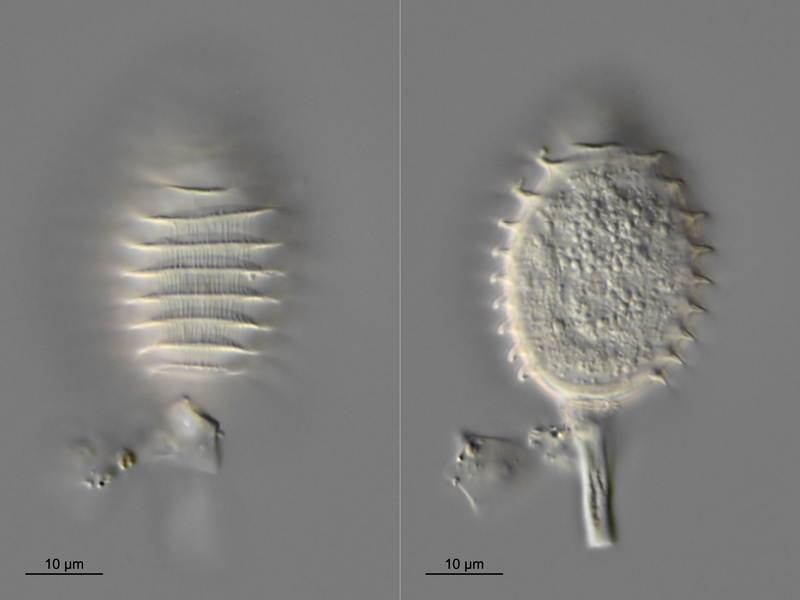 Das Sauginfusor Podophrya globulifera – Teil 3