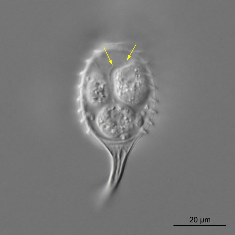 Das Sauginfusor Podophrya globulifera – Teil 3