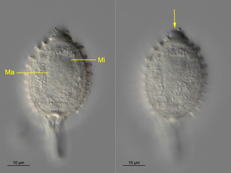 Das Sauginfusor Podophrya globulifera – Teil 3