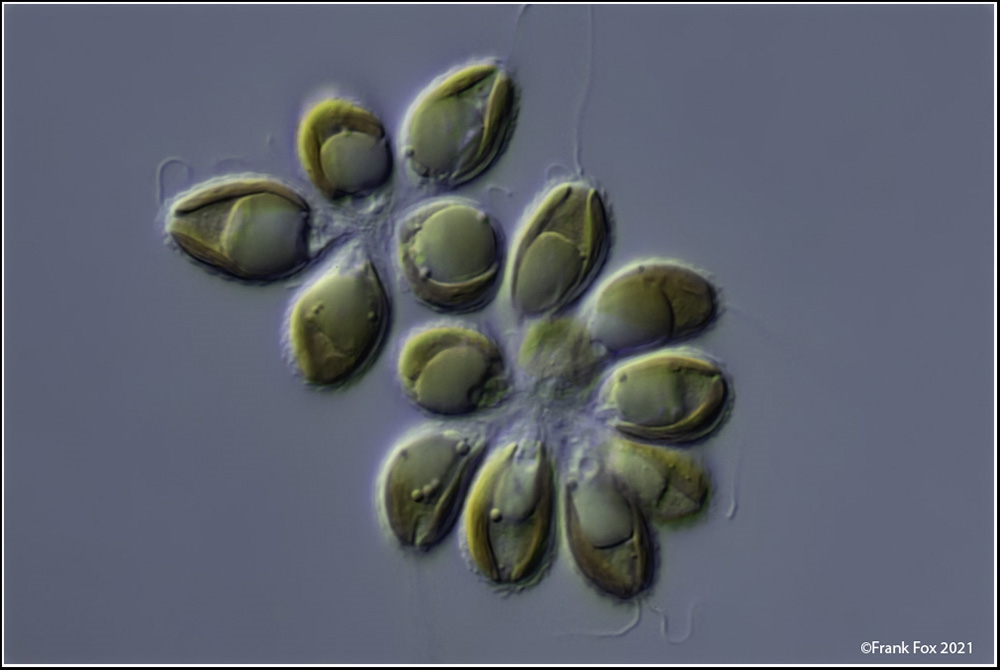 Mikroaufnahmen Algen 3