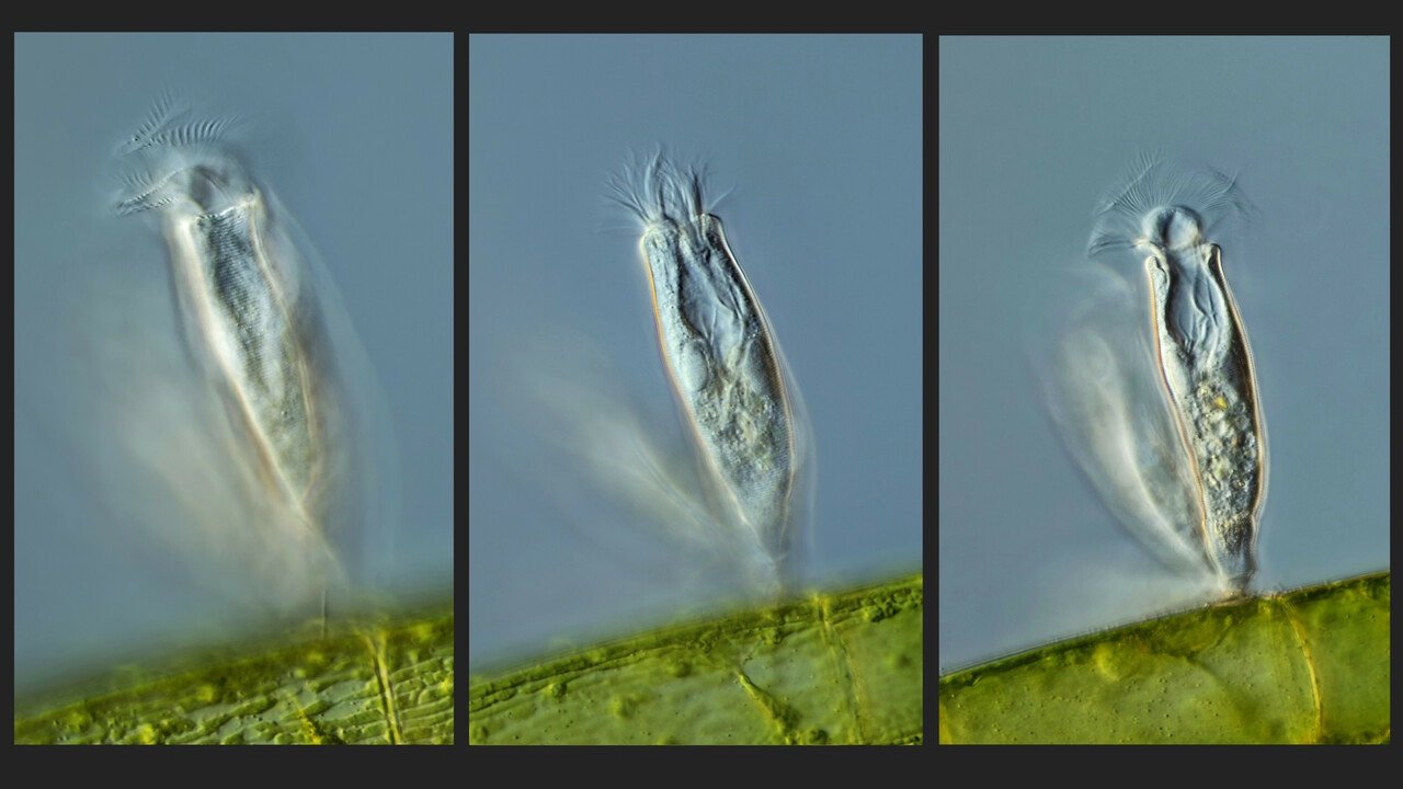 Schöner Gehäuse-Ciliat - Vermutlich Cothurnia