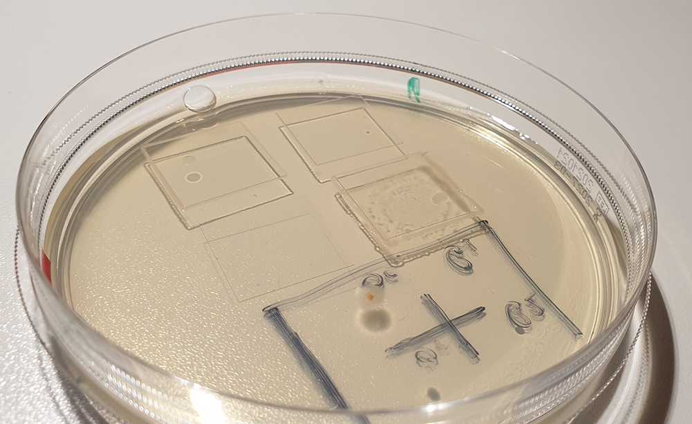 Wachsende Schimmelpilze auf dem Deckglas