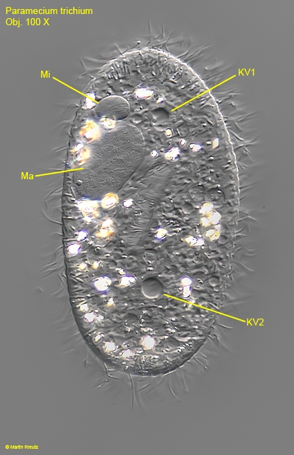Paramecium trichium - der kleine Bruder