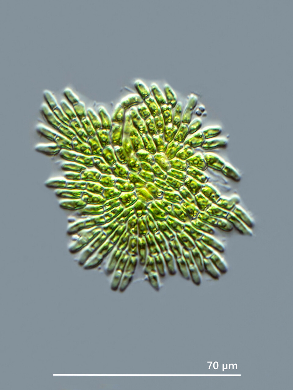 Frühling im Moosaquarium - Coleochate-Algen