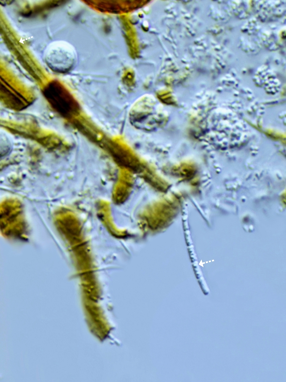 Ockerbakterium Leptothrix ochracea