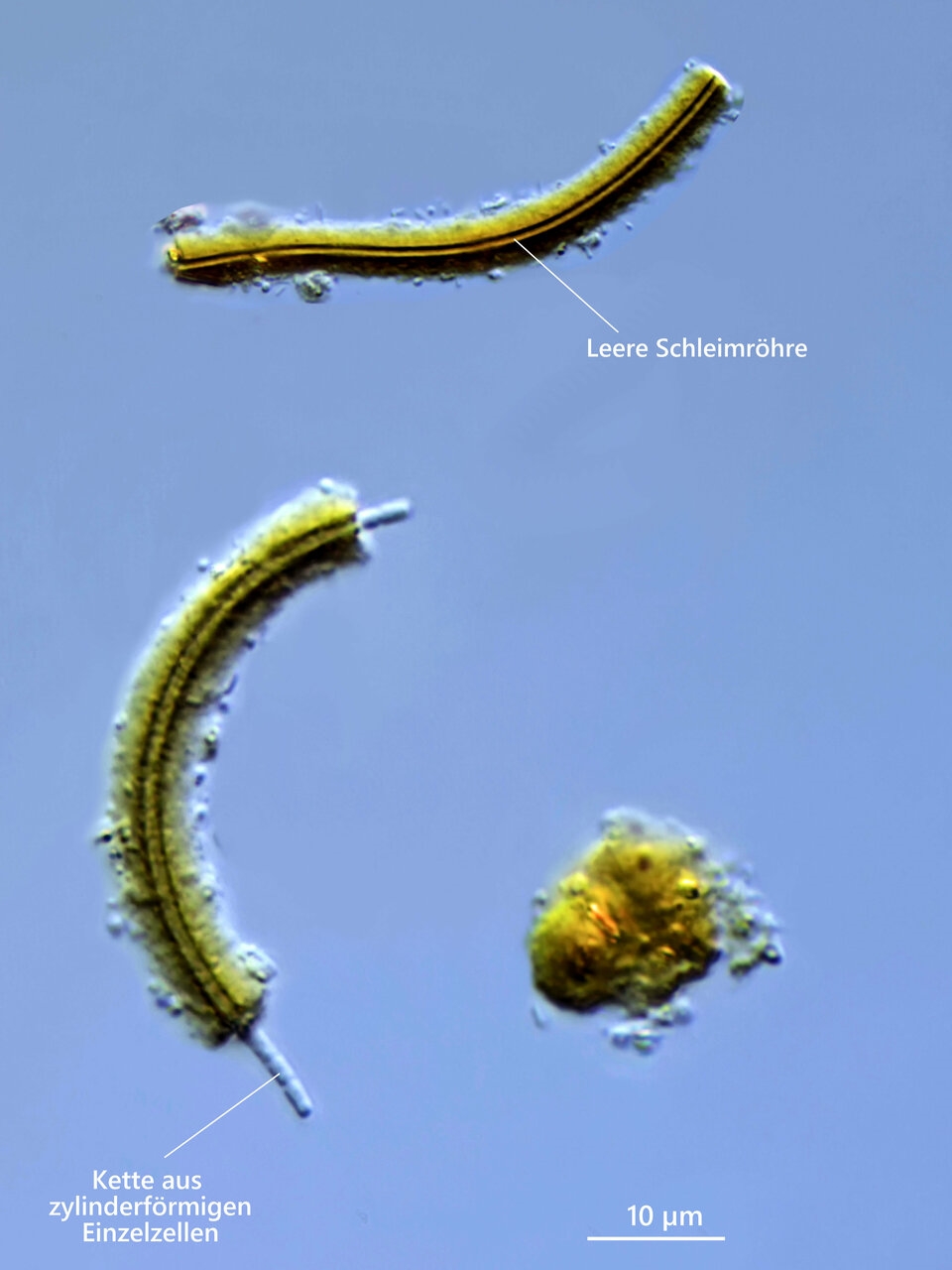 Ockerbakterium Leptothrix ochracea