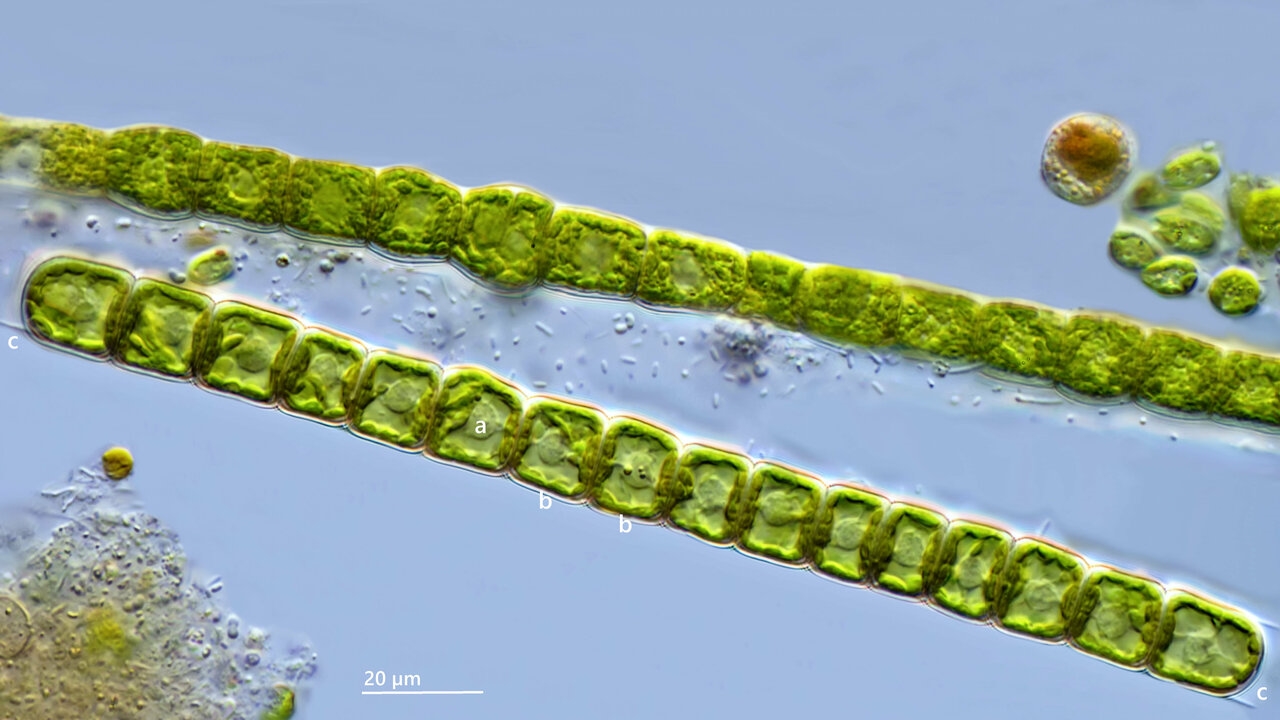 Der Grünalgen-Faden Microspora sp