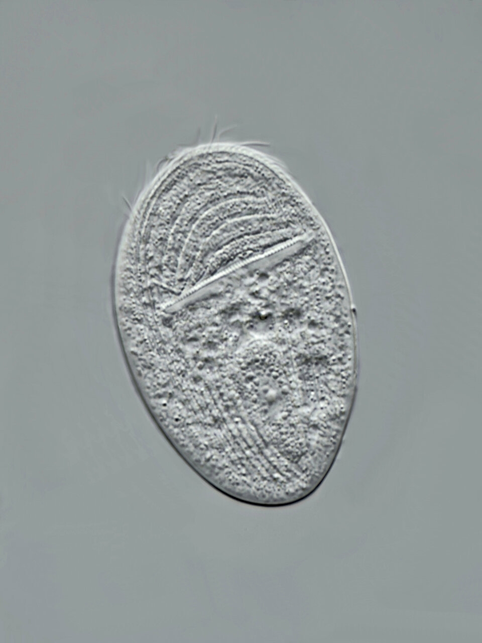 Gastronauta membranaceus - Ein eher seltener Ciliat