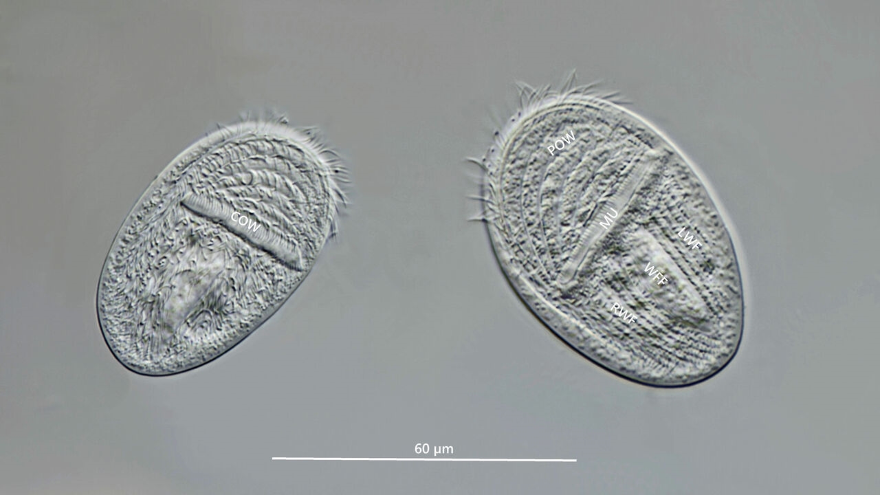 Gastronauta membranaceus - Ein eher seltener Ciliat